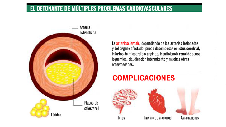 La presencia de ateroma en cualquier arteria demuestra que ya hay daño ...